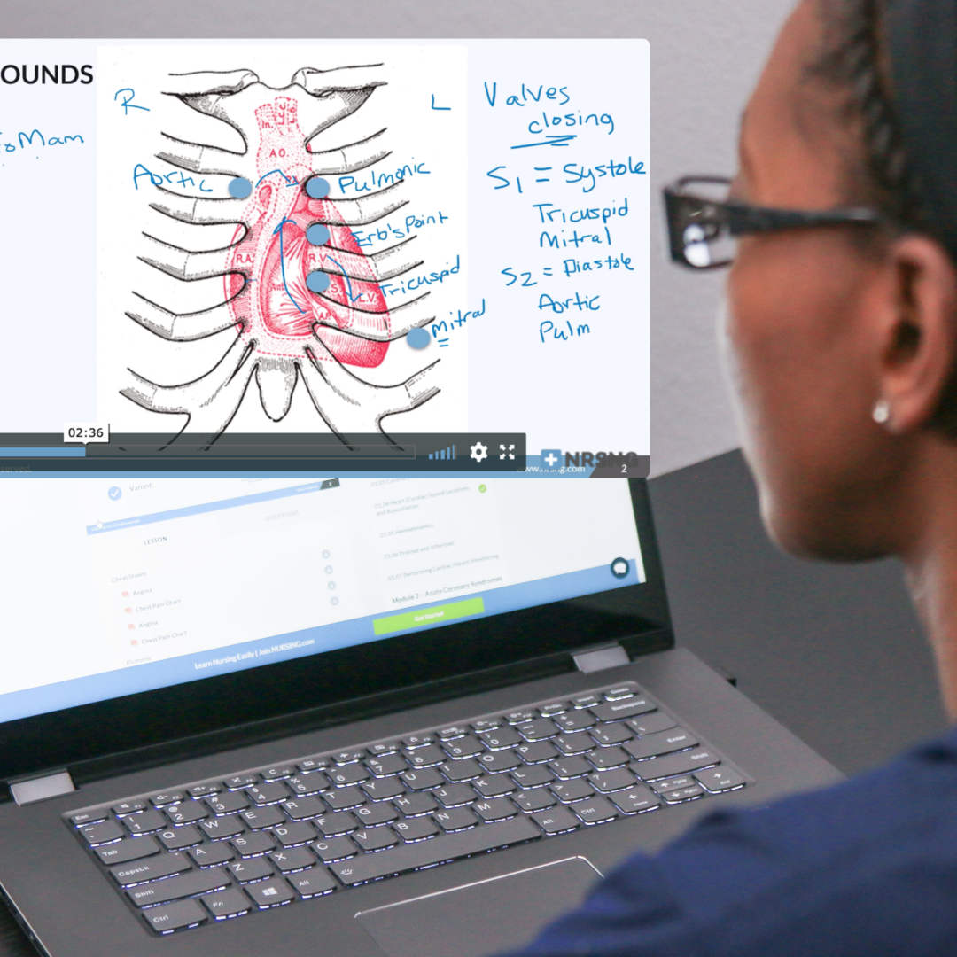 SIMCLEX: Personalized NCLEX Simulator & Study Tools – Master the NCLEX ...